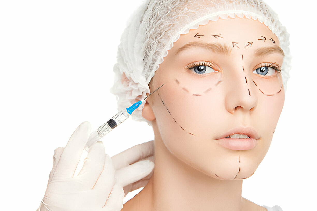 Endolifting Facial – Dra Gabriela Coa